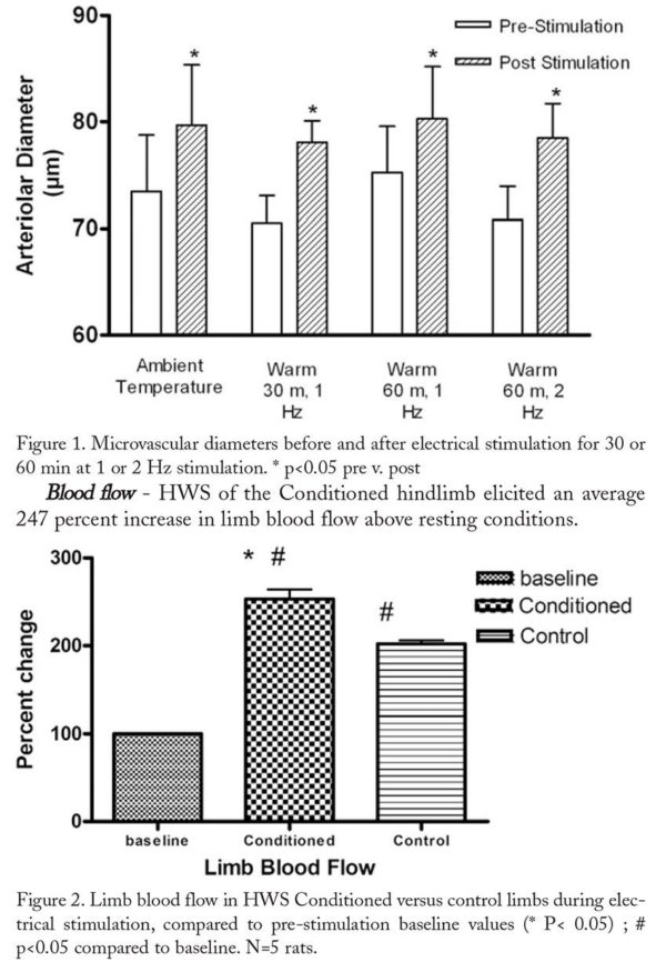 Research Measures How H‑Wave Stimulation Effects Blood Flow - H-Wave